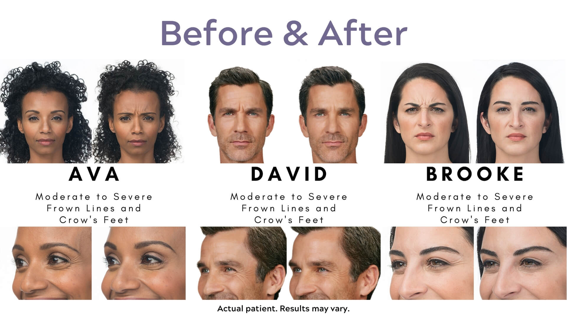 Botox - Argyle Med Spa & Wellness Center