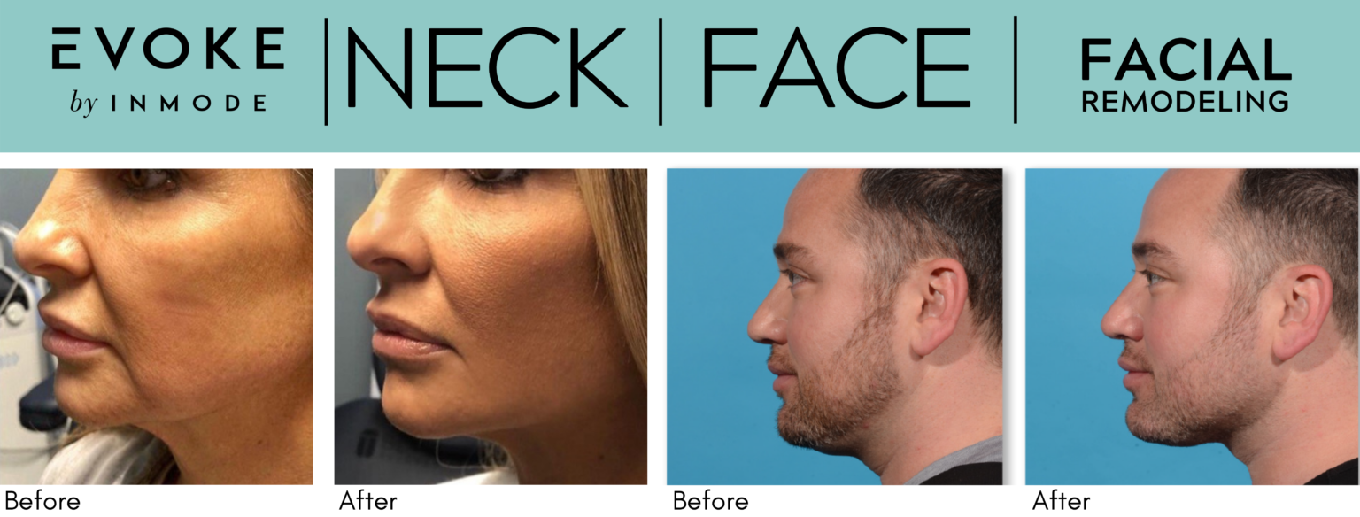 Body Contouring Overview - Argyle Med Spa & Wellness Center